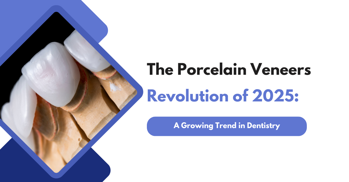Best Porcelain Veneers Treatment in Chennai – 2025 Revolution